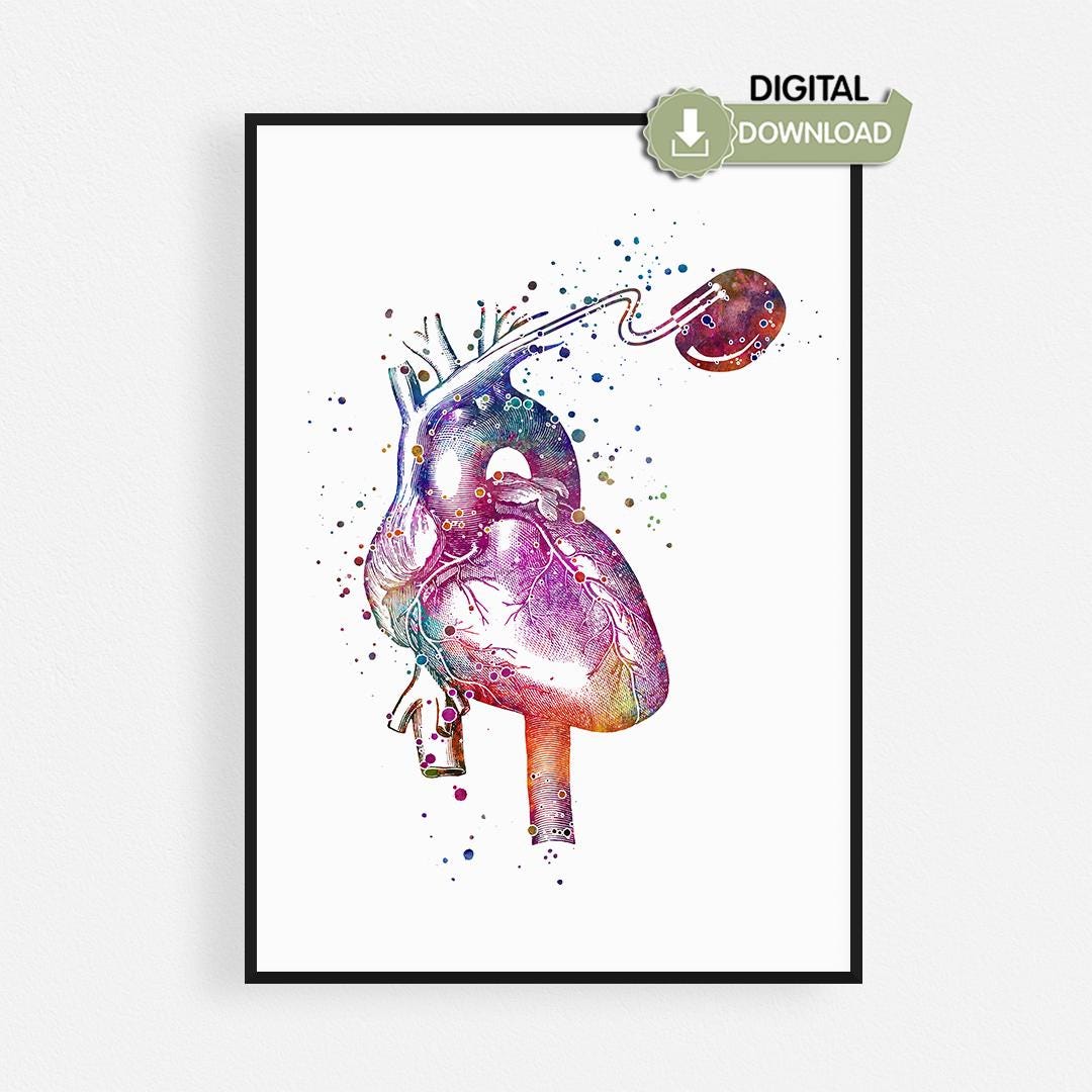 Pacemaker Heart Watercolor Printable, Cardiology Wall Art, Cardiac ...