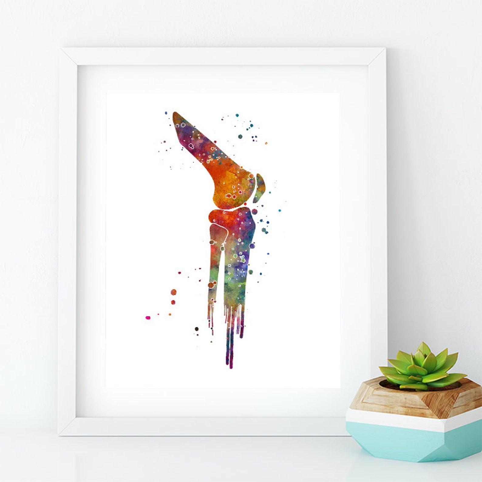 Knee Joint Anatomy Art Watercolor Print Orthopedic Surgeon | Etsy