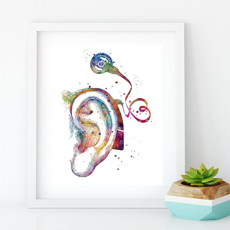 Cochlear Implant Poster Watercolor Art Print Hearing Loss - Etsy
