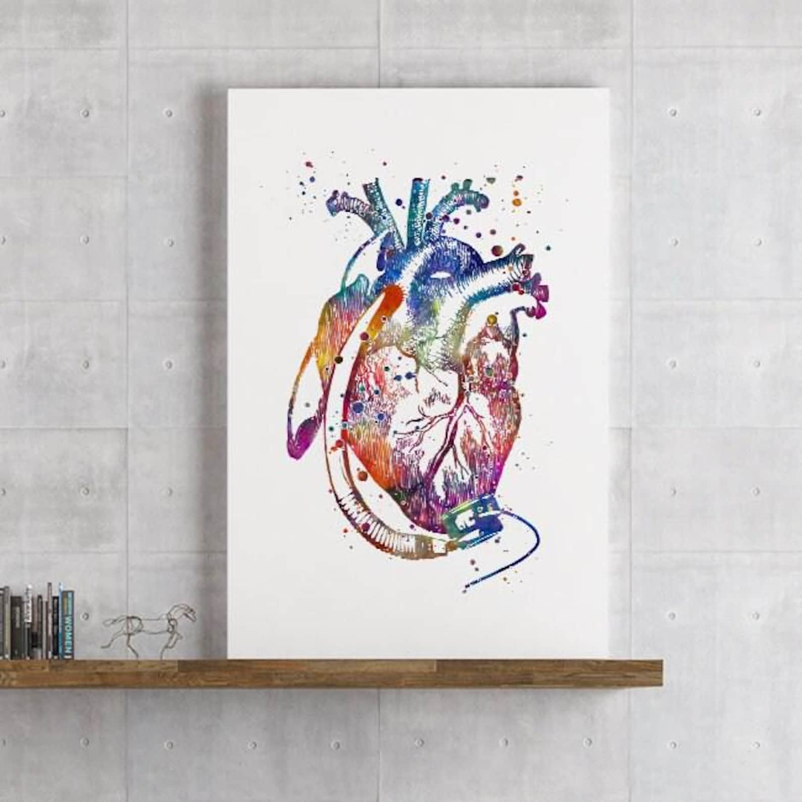 Heart With Left Ventricular Assist Device - LVAD Implant Surgery - Etsy ...
