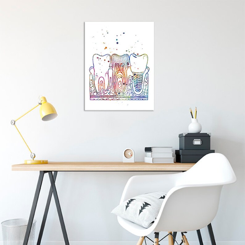 Dental Implant Art Dentist Office Decor Dental Anatomy Print - Etsy