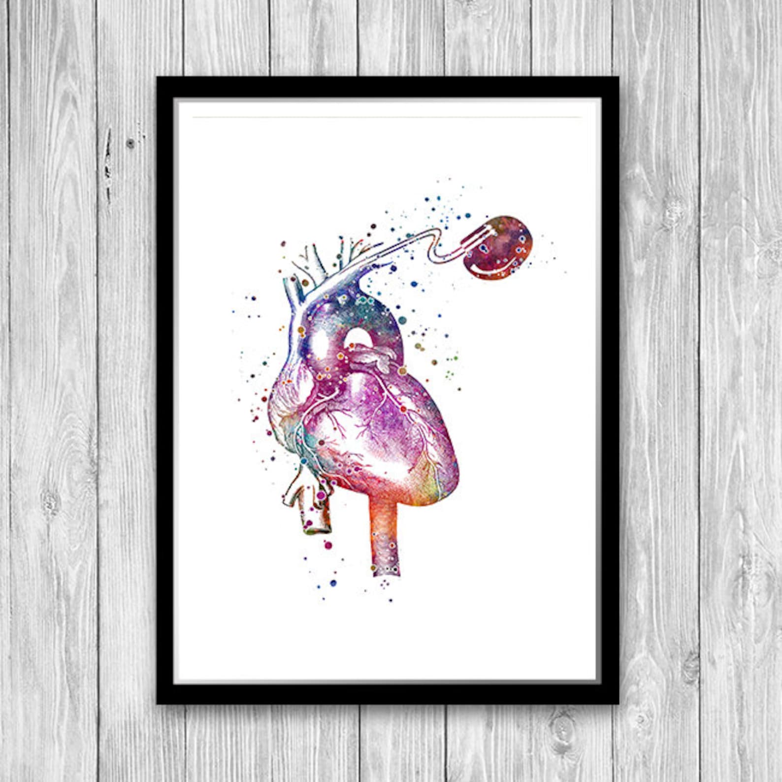 Heart Pacemaker Cardio Stimulator Watercolor Art Print - Etsy
