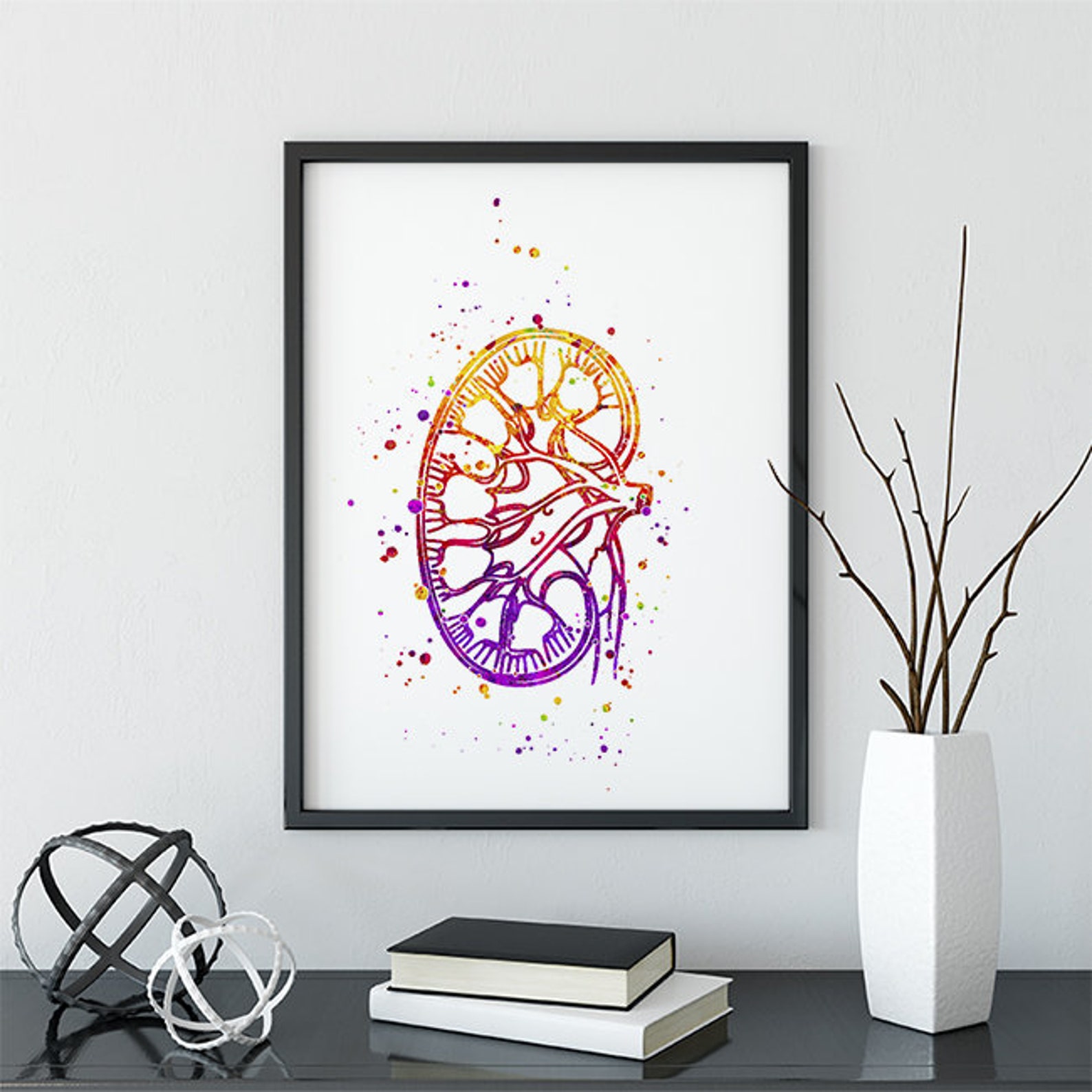 Urology Art Kidney Urinary Tract System Bladder Anatomy Art | Etsy