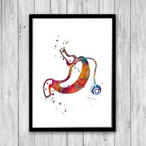 Gastric Band, Bariatric Surgery, Weight Loss Surgery Watercolor Art ...