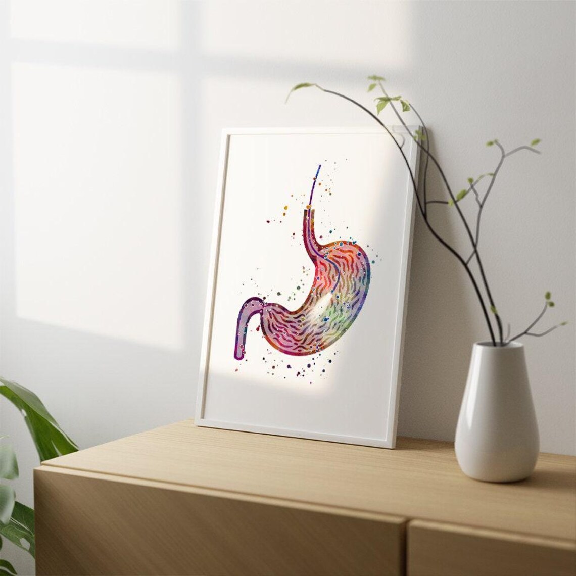 Endoscopy Gastroenterology Watercolor Art Print, Endoscope Multicolored ...