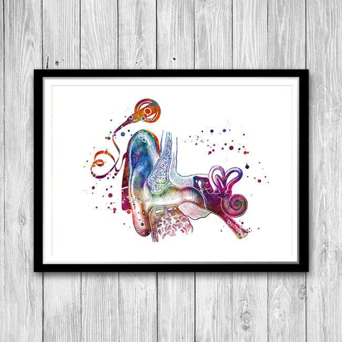Cochlea Implant, Audiology Art Watercolorprint, Hearing Loss Treatment ...