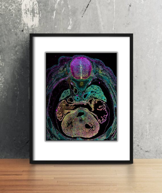 Heart & Lungs 2 Immunofluorescence Cell Art - Etsy