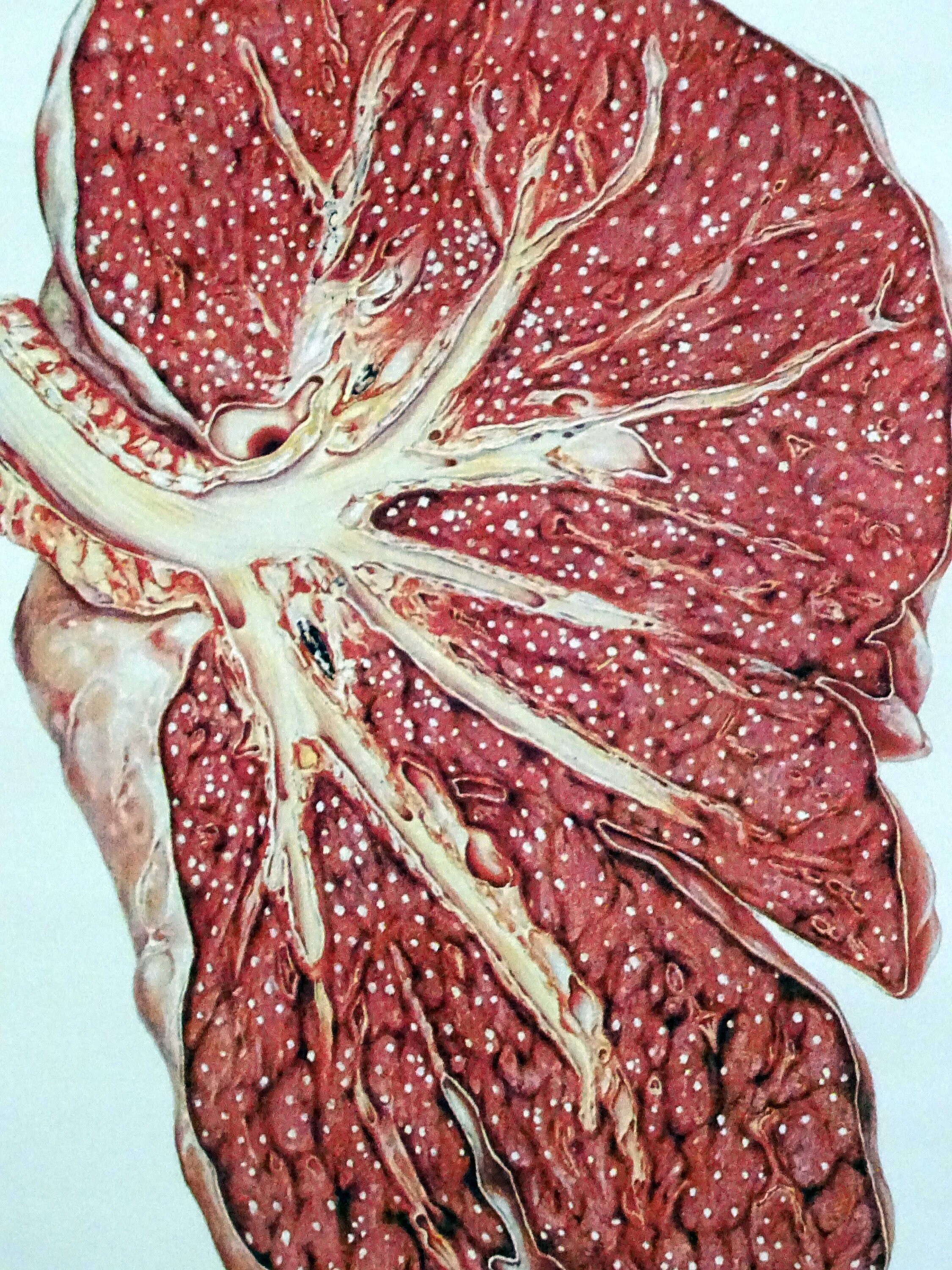 Vintage School Chart Tuberculosis 1990s Retro Vintage - Etsy