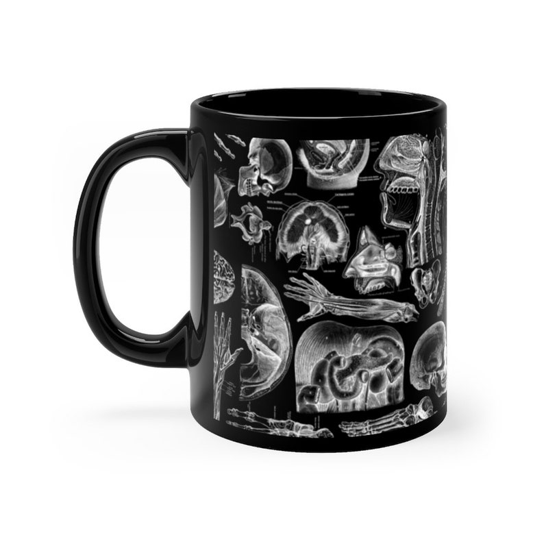 Human Anatomy White Print on Black Mug 11oz - Etsy