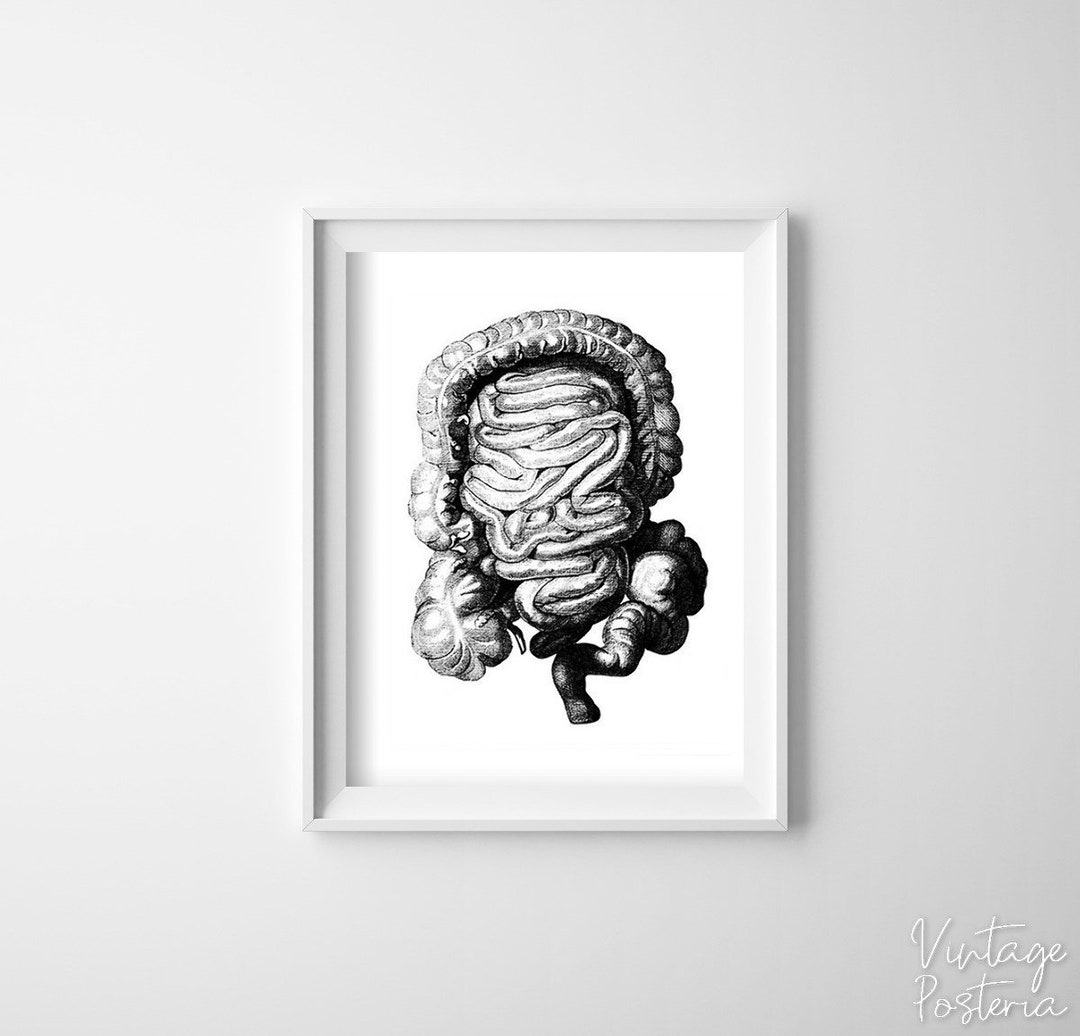 Anatomical Print Large Intestine Canvas Poster, Illustration Print ...