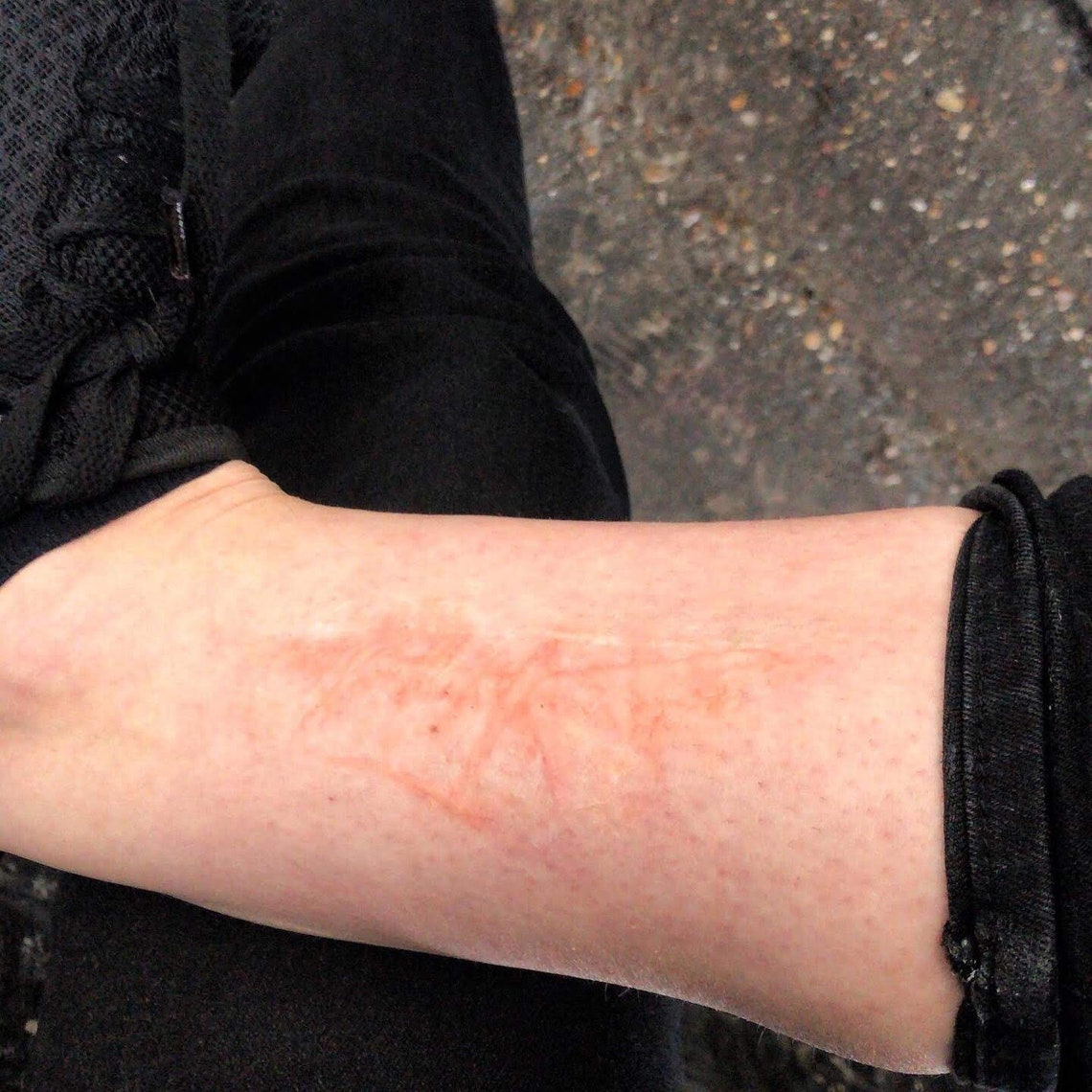 Prosthetic Keloid Scar / Prosthetic Laceration / Wound / Cuts - Etsy UK