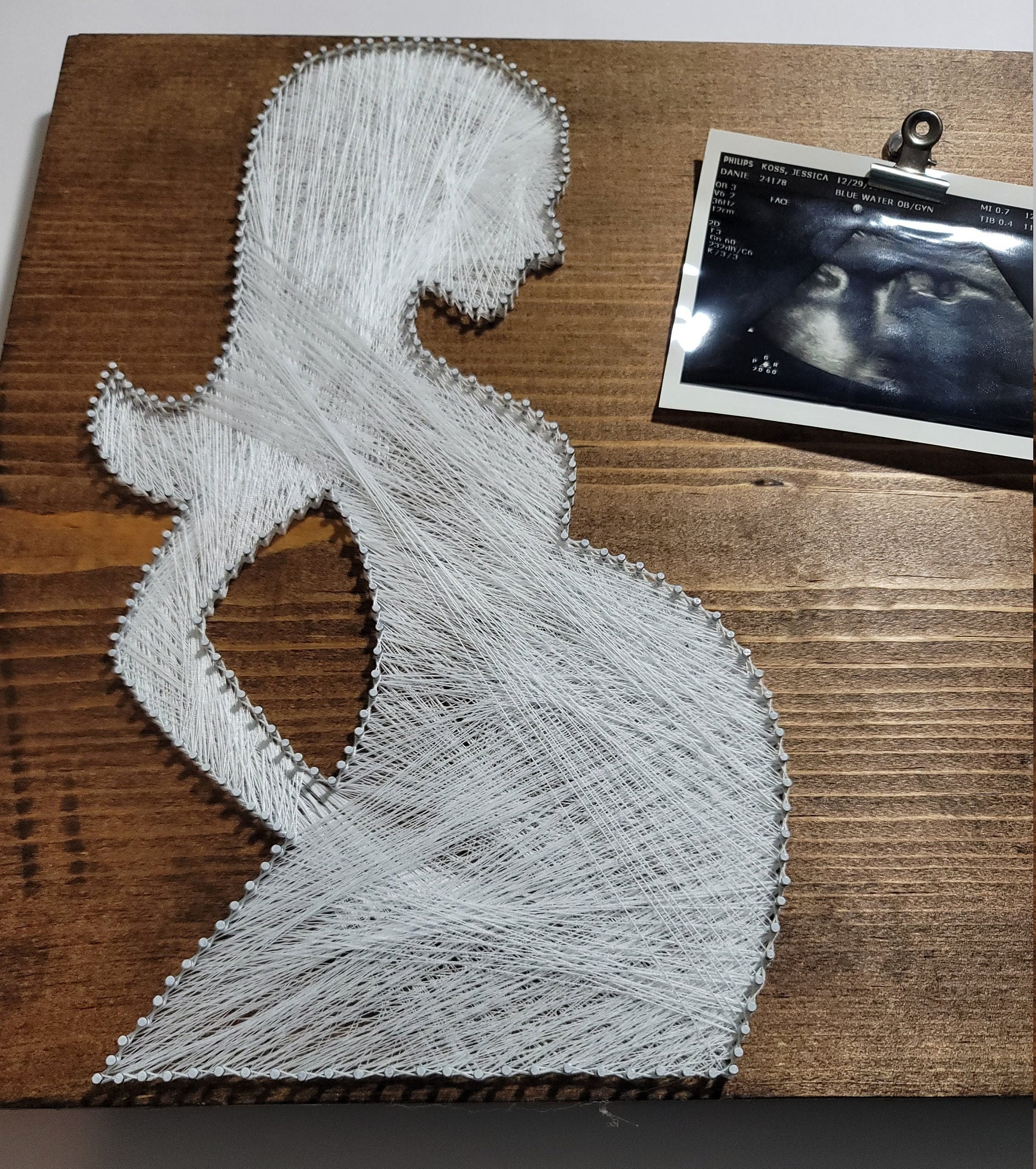 Ultrasound String Art Photo Sign Maternity Baby Announcement Pregnancy ...
