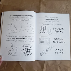 Tubie Activity Book for Kids (medical Learning, Paperback, Interactive ...