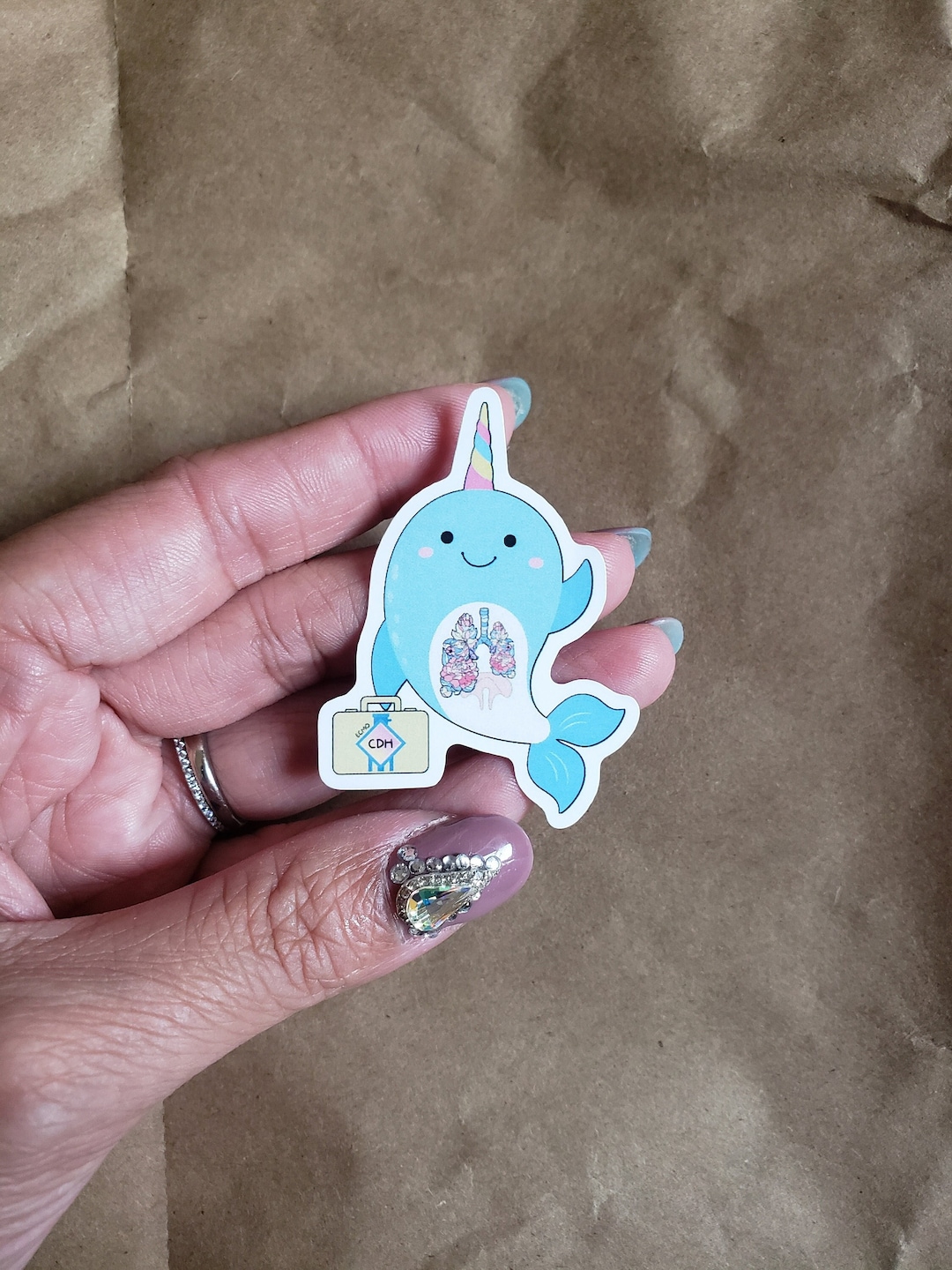 CDH ECMO Ready Narwhal (congenital Diaphragm Hernia, CDH, Nicu, Special ...