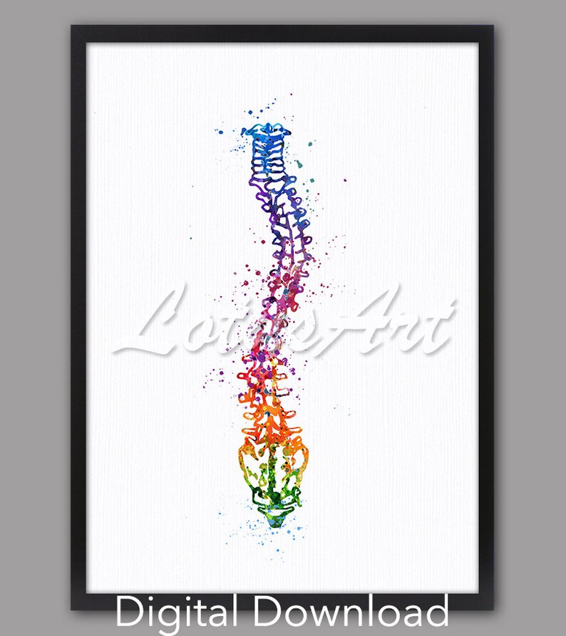 Scoliosis Spine Watercolor Art Print: Anatomy Poster (digital Download ...