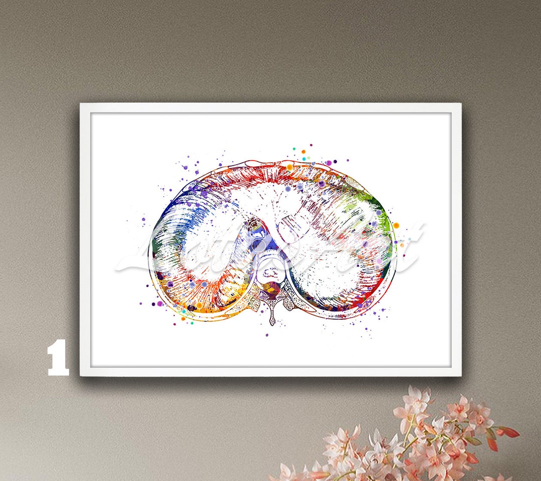 Thoracic Diaphragm Art Framed Watercolor Print Abdominal Cavity Medical ...