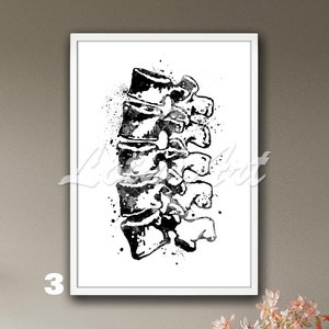 Lumbar Vertebrae Framed Print Anatomy Poster Doctor Office Gift ...
