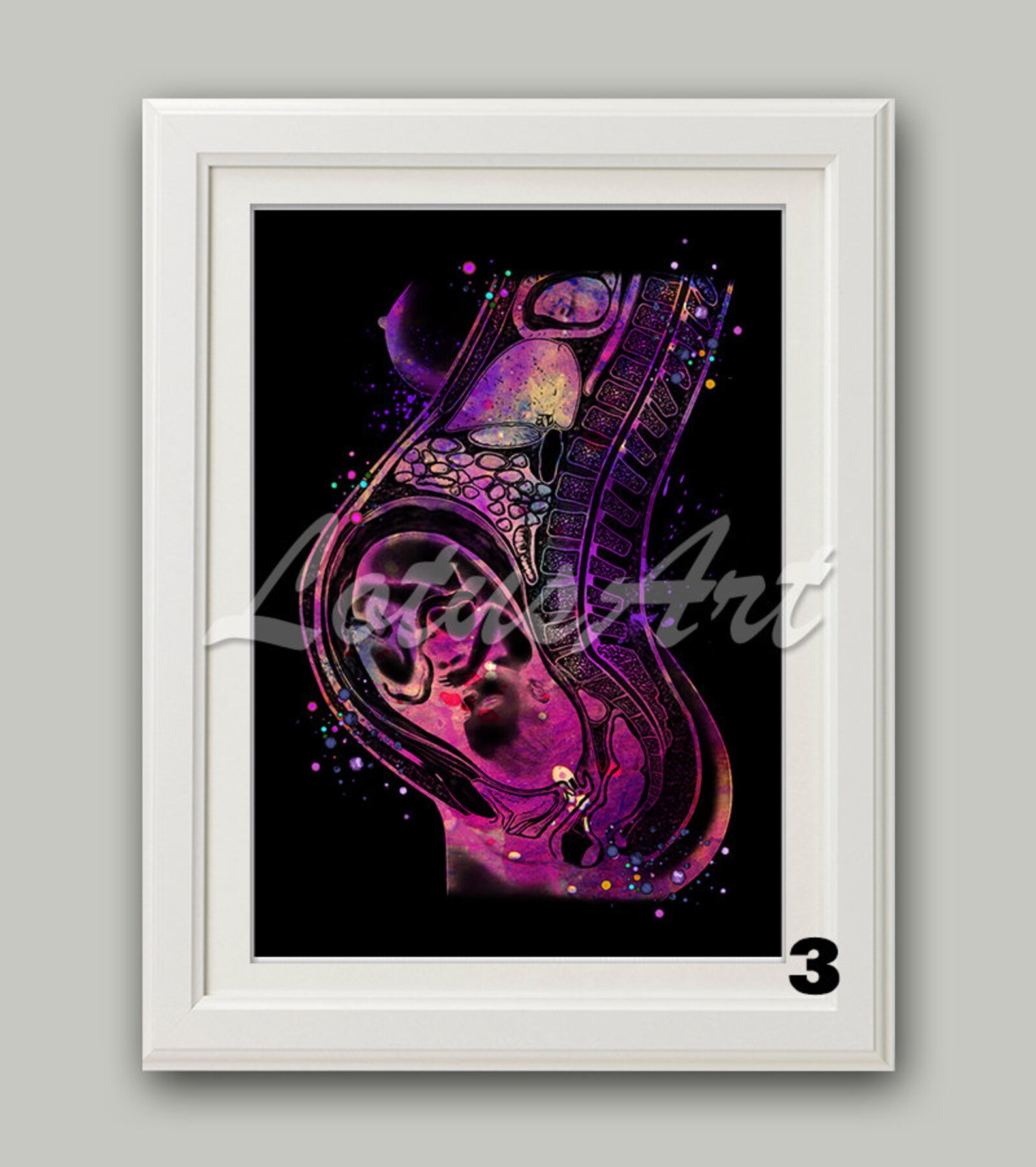 Pregnancy Wall Art Black Background Watercolor Print Expect - Etsy