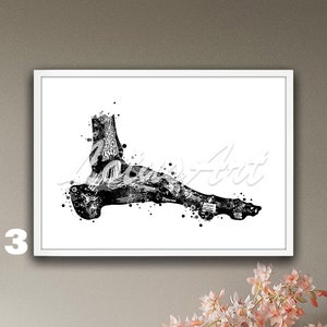 Human Foot Bones Print Anatomy Framed Art Poster Clinic Wall Decor ...