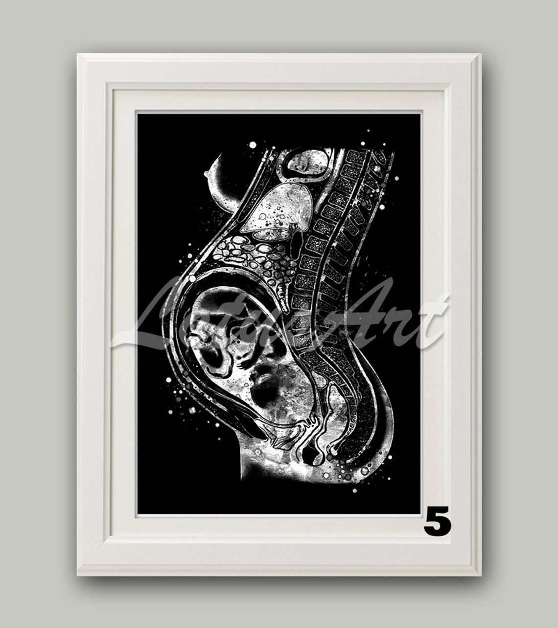 Pregnancy Wall Art Black Background Watercolor Print Expect - Etsy