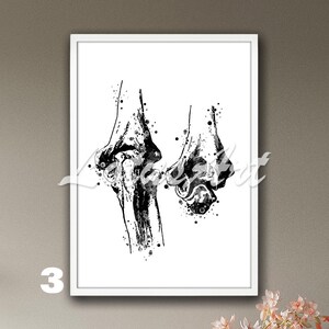 Elbow Joint Wall Art Framed Anatomy Medical Print Arm Bones ...