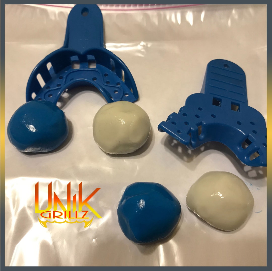Extra Custom Mold Kit for Grillz - Etsy
