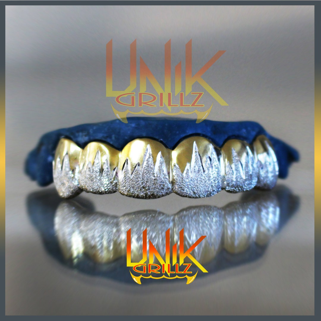 Custom Grillz With Ice Mountains Diamond Dust - Etsy