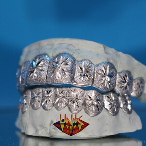 Custom Grillz With Sunburst Cuts and Diamond Dust - Etsy