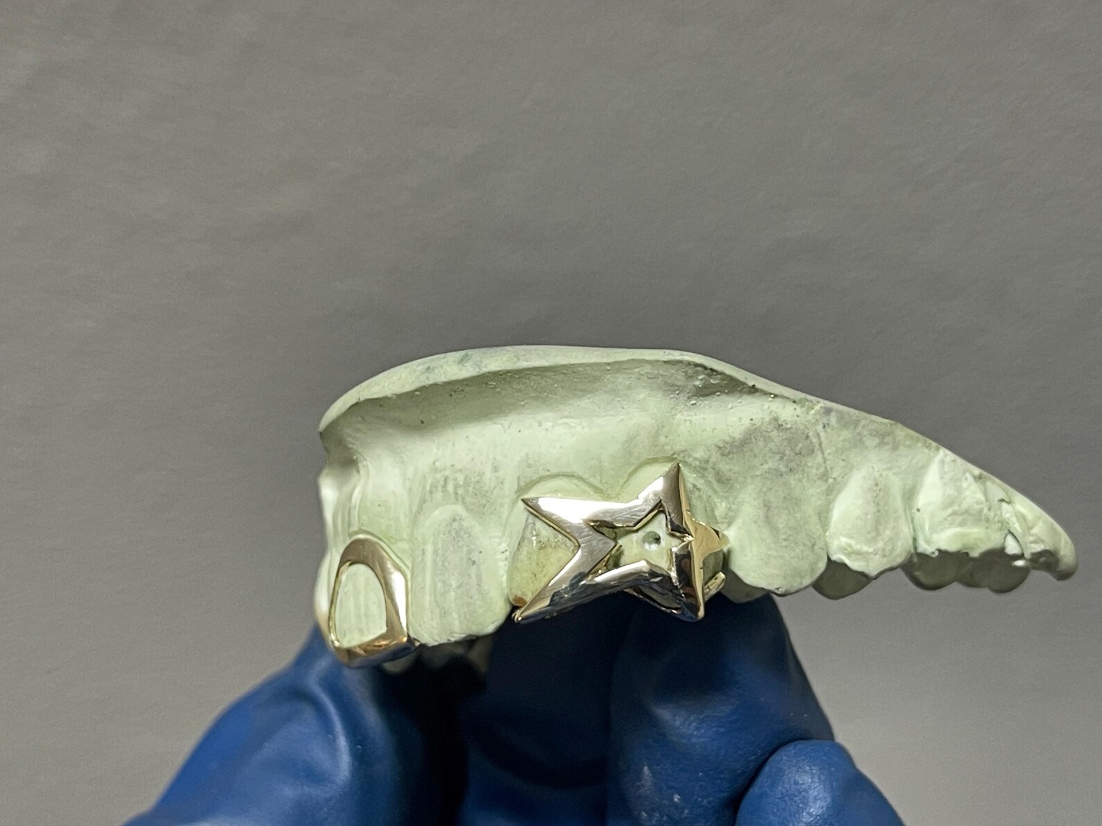 Custom Star Grillz by Unik - Etsy