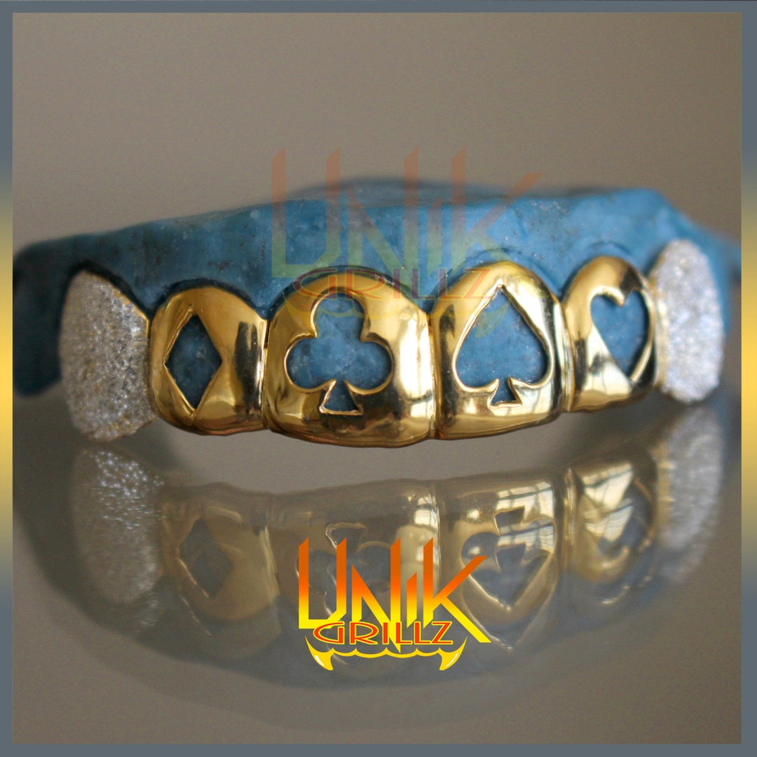 Custom Open Face Card Suit Grillz - Etsy