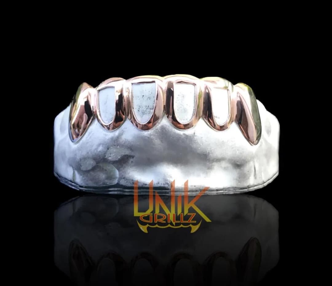 Custom Openface Solid Grillz - Etsy