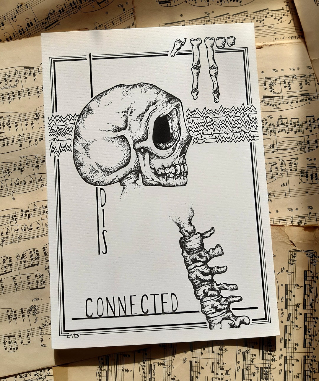 Art Print A4 Disconnected/dissociative Bones - Etsy