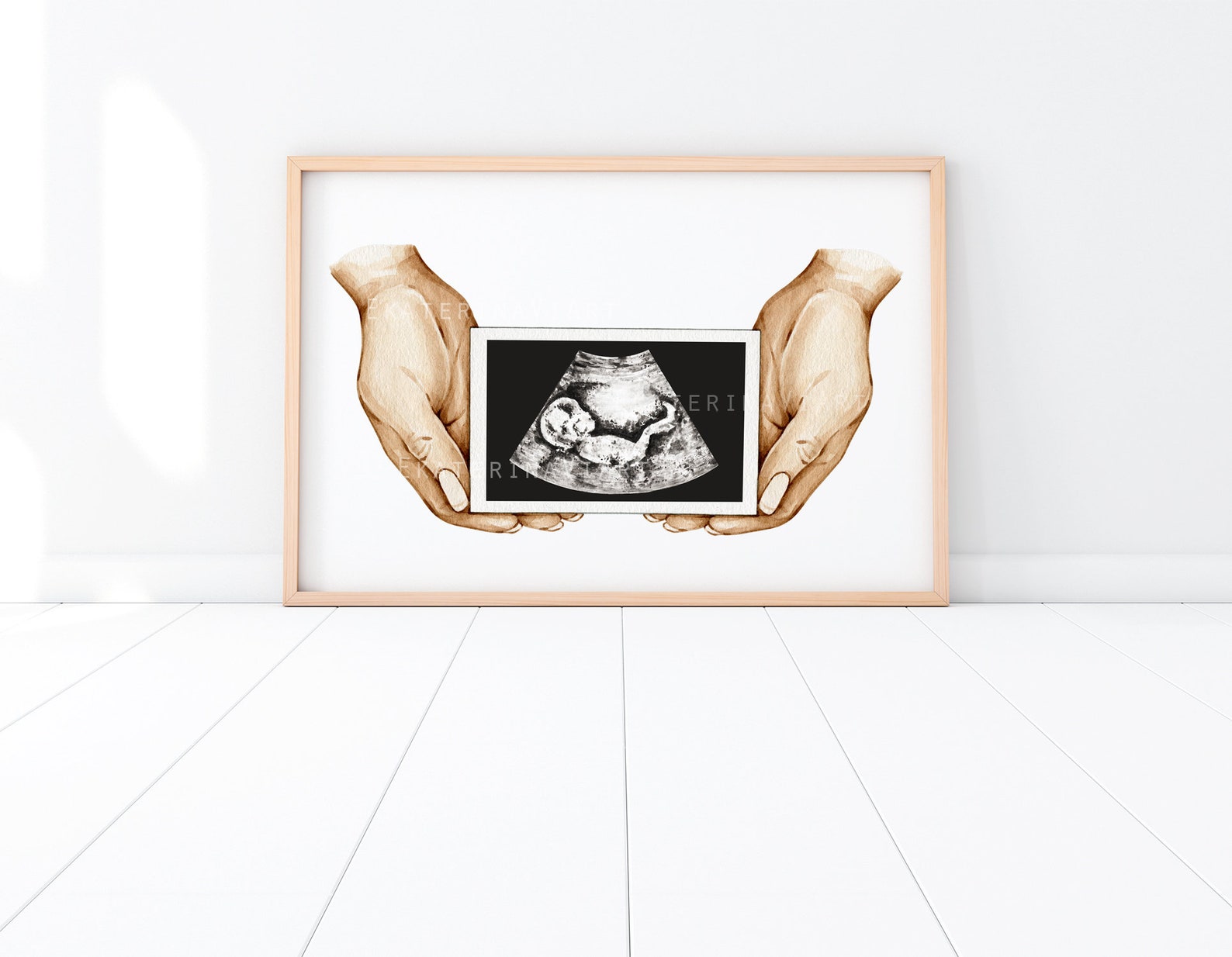 Baby Scan Ultrasound Watercolour Print Pregnancy Personalised | Etsy