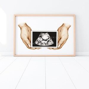 Baby Scan Ultrasound Watercolour Print Pregnancy Personalised First ...