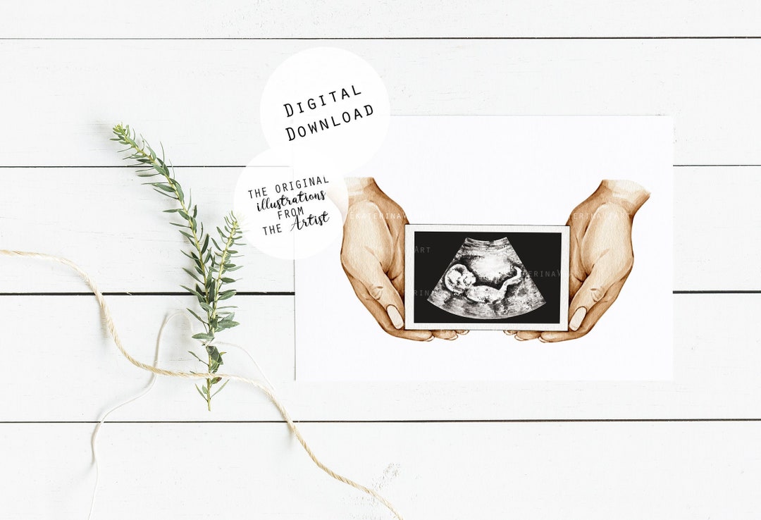 Baby Scan Ultrasound Watercolour Print Pregnancy Personalised First ...