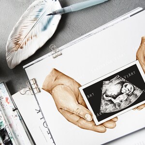 Baby Scan Ultrasound Watercolour Print Pregnancy Personalised First ...