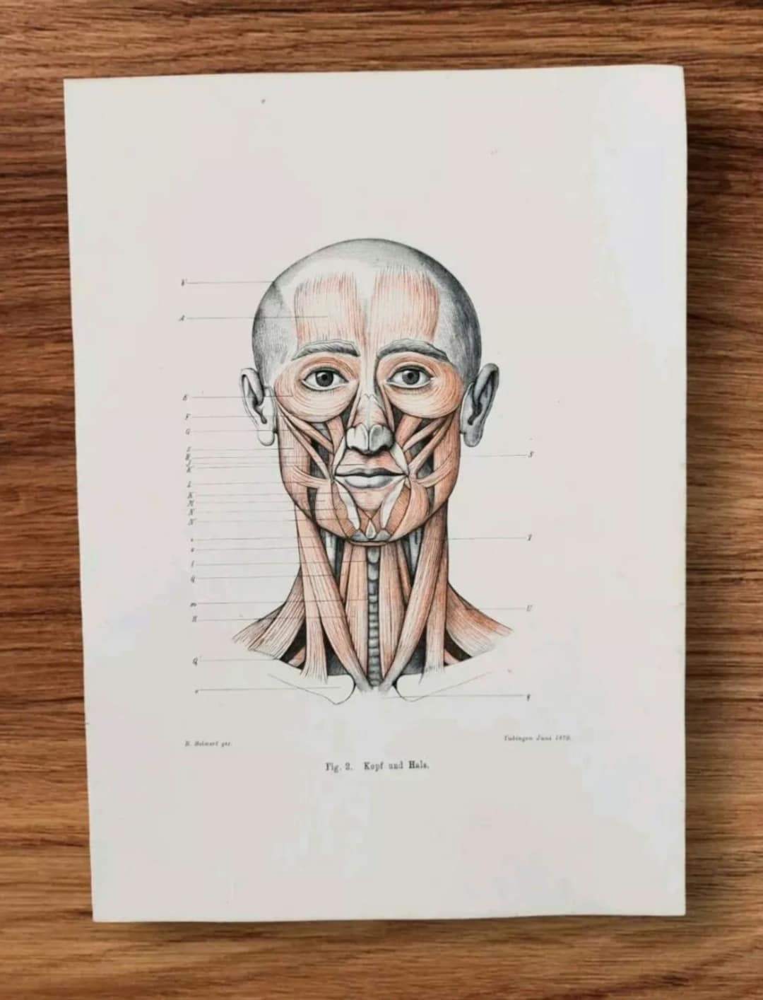 Antique 1899 Anatomy Lithograph: Human Head Diagram, Medical Wall Art ...