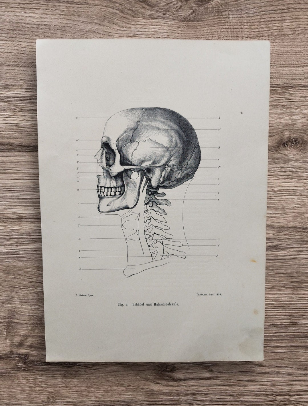 Antique 1899 German Anatomy Human Head Skull Book Print Picture ...