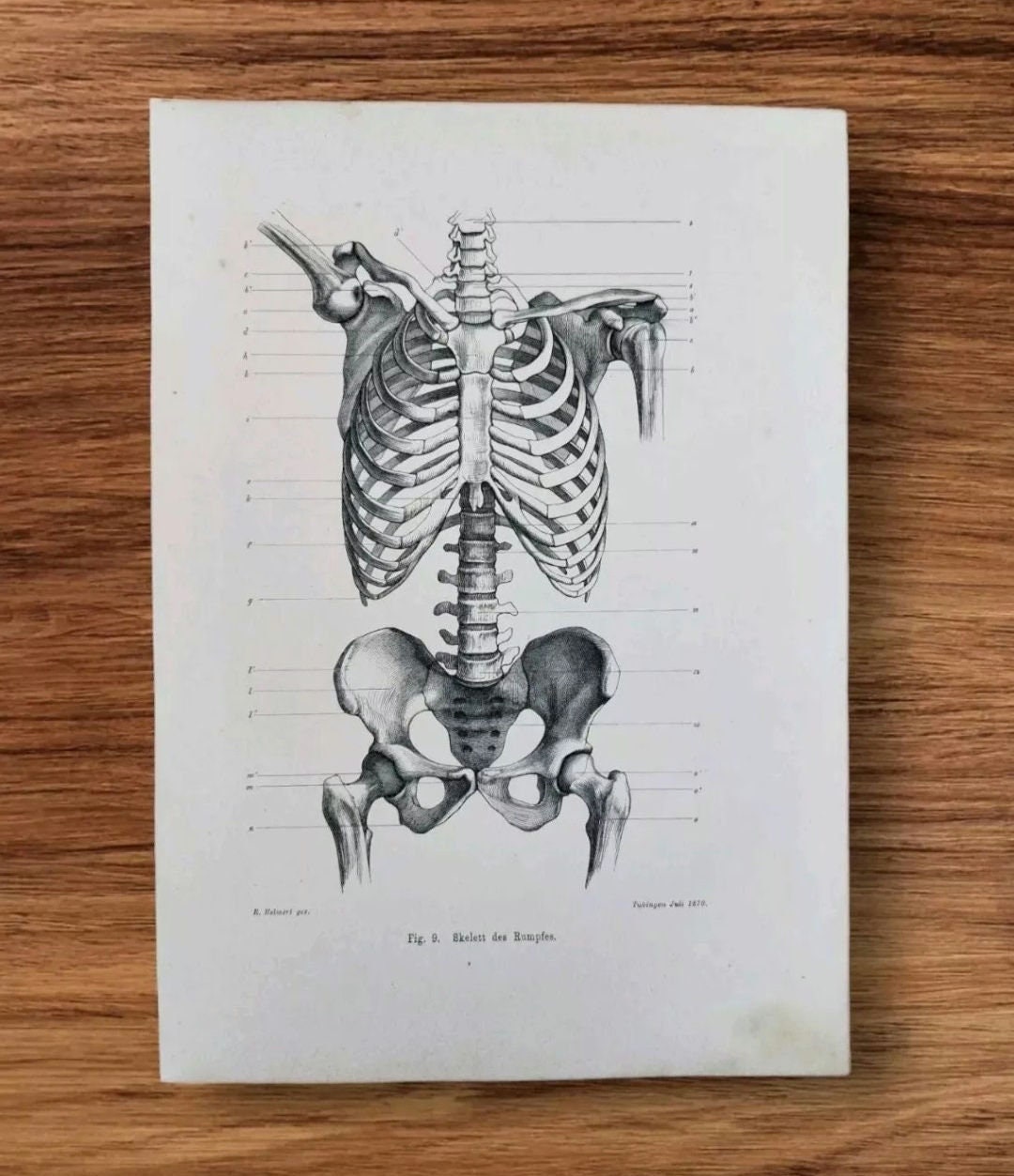 Genuine Antique 1899 Human Skeleton Anatomy Male Trunk Book Print ...