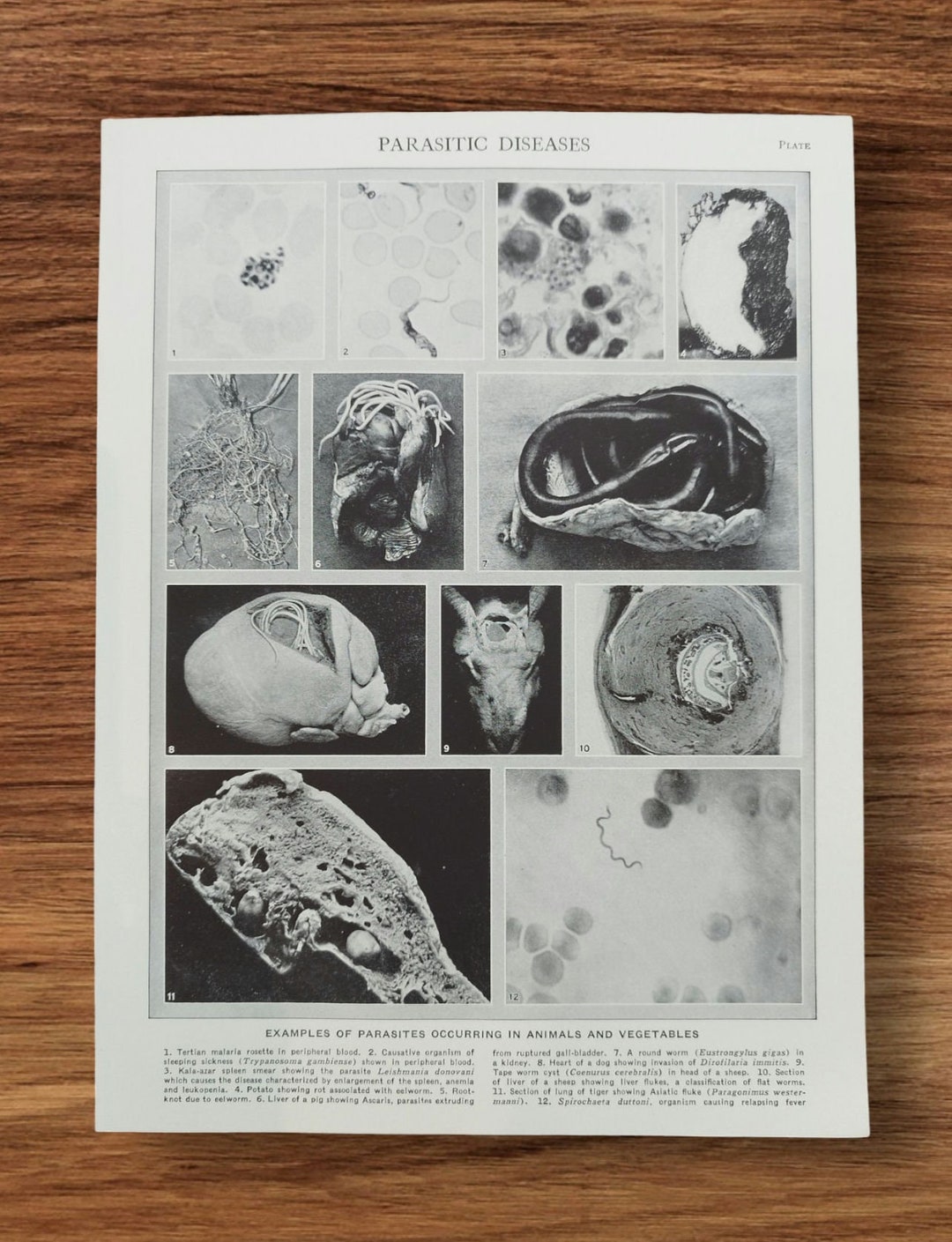Vintage 1950s Parasitic Diseases Book Print Picture Lithograph ...