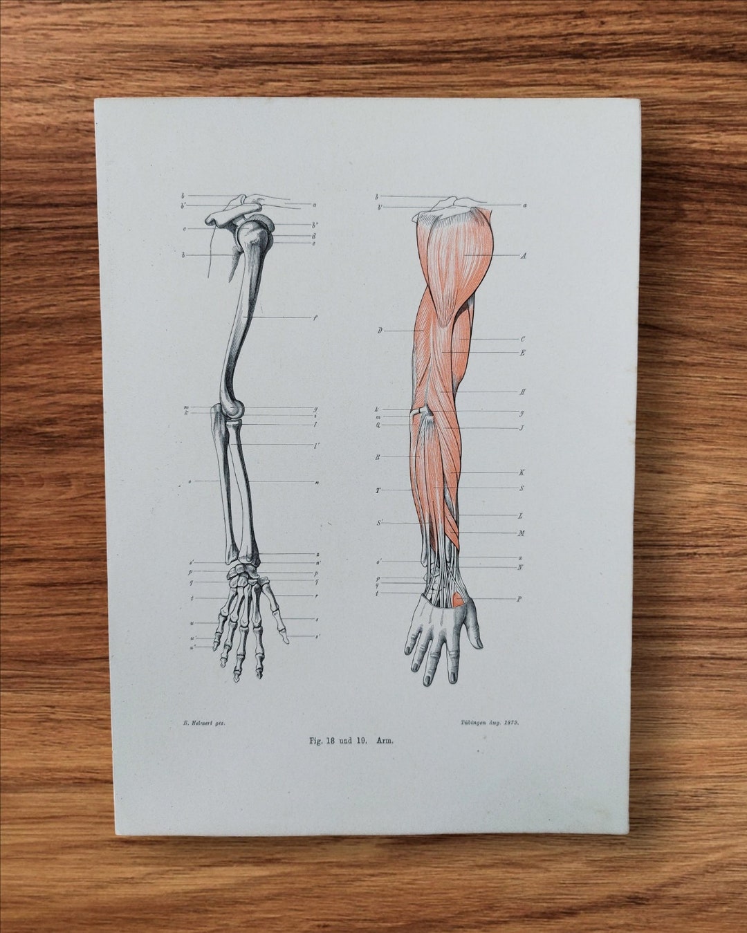 Original Antique 1899 German Skeleton Anatomy Human Male Arm Hand Book ...