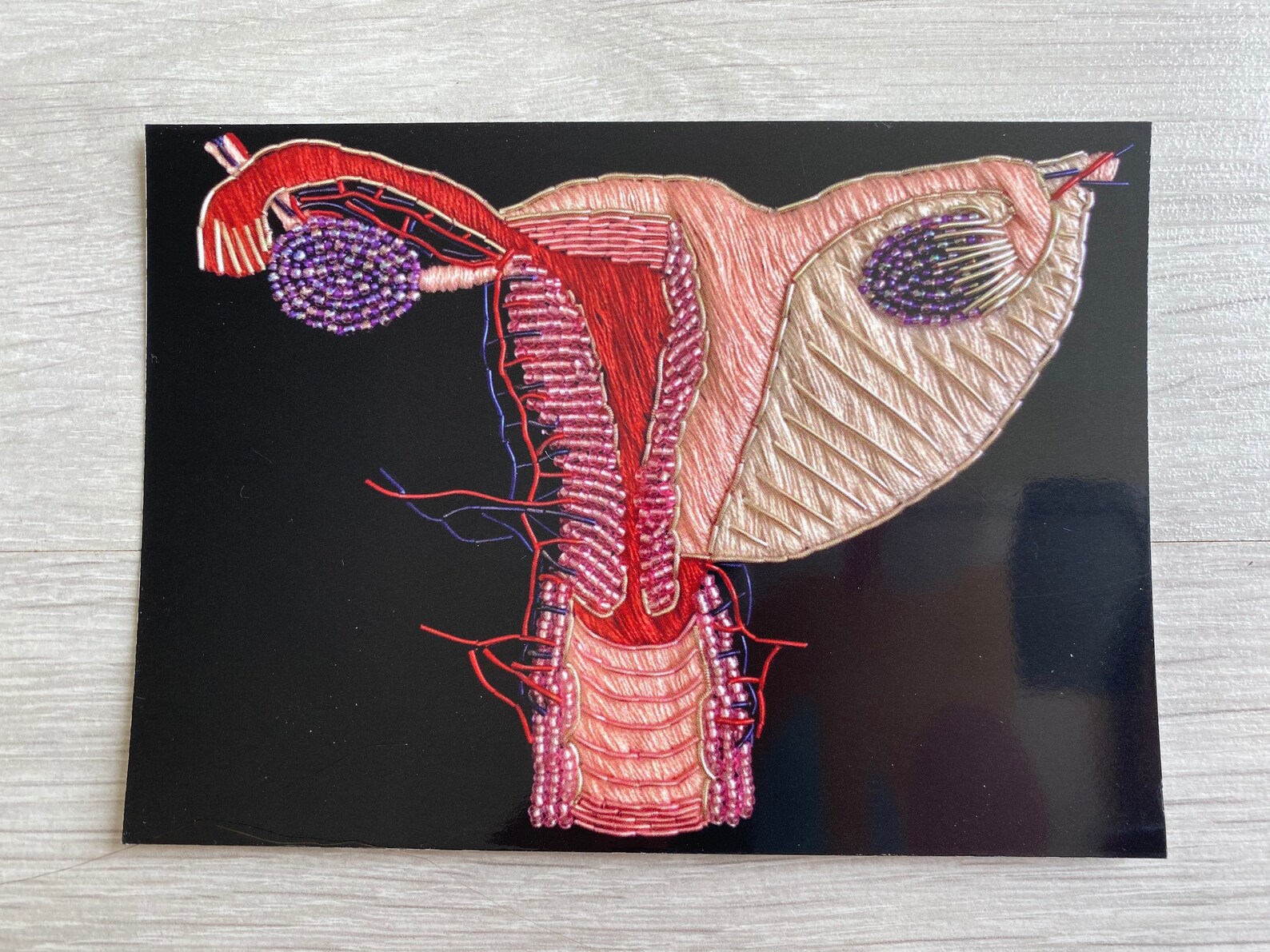 Uterus Anatomy Embroidery A6 Print - Etsy