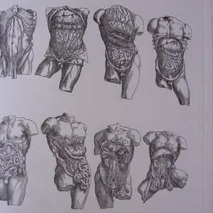 History of Medical Illustrations From Antiquity to 1600 Editions ...