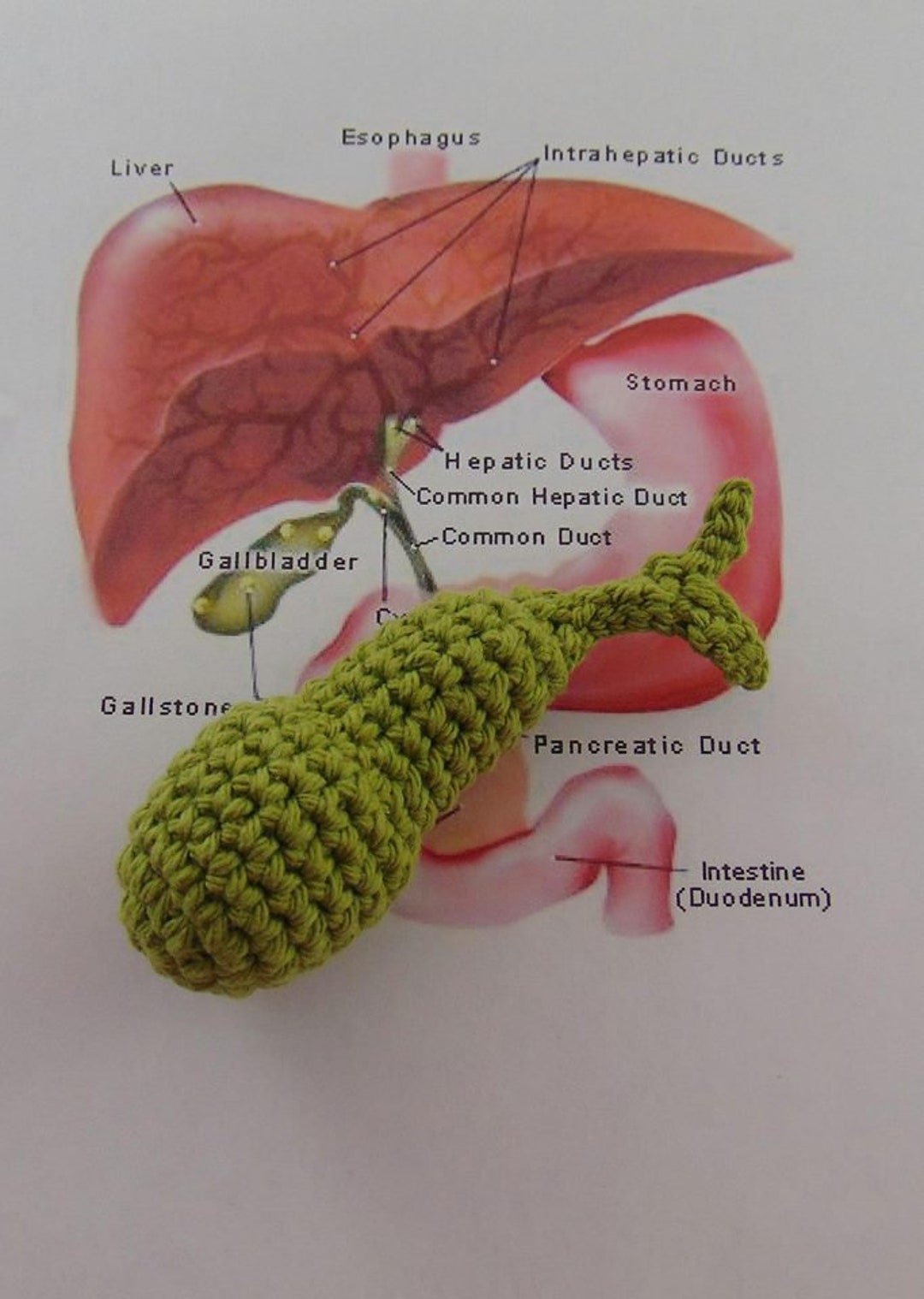 Crocheted Cranky Gallbladder - Etsy