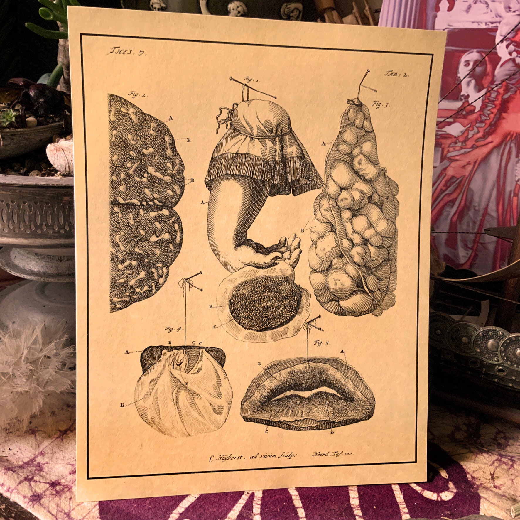 Frederik Ruysch Collection Fine Art Prints/posters Anatomy - Etsy