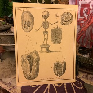 Frederik Ruysch Collection - Fine Art Prints/posters - Anatomy ...