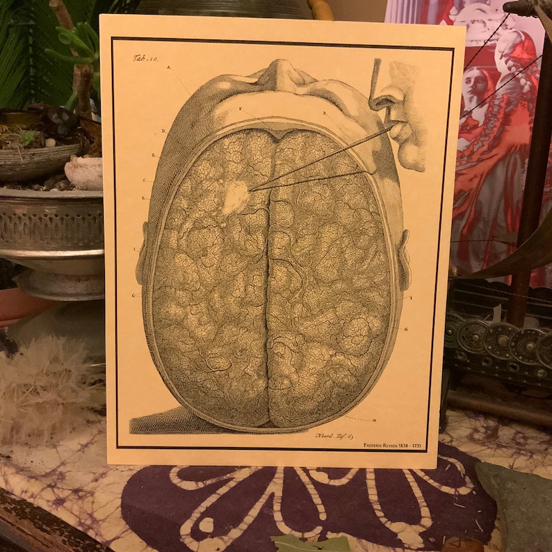 Frederik Ruysch Collection Fine Art Prints/posters Anatomy | Etsy