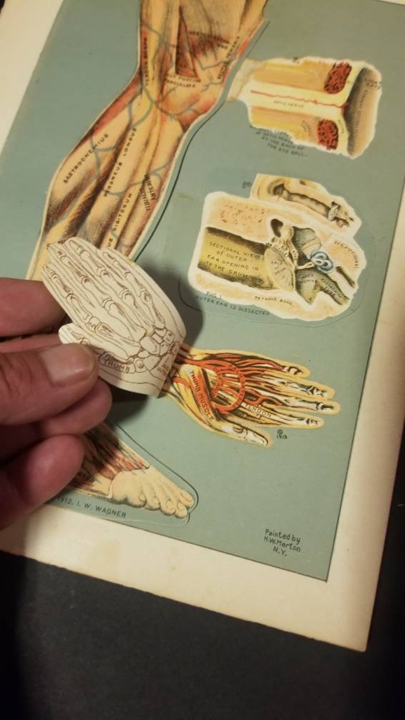 Antique Medical Overlays Book Plate Medical Lithographs - Etsy