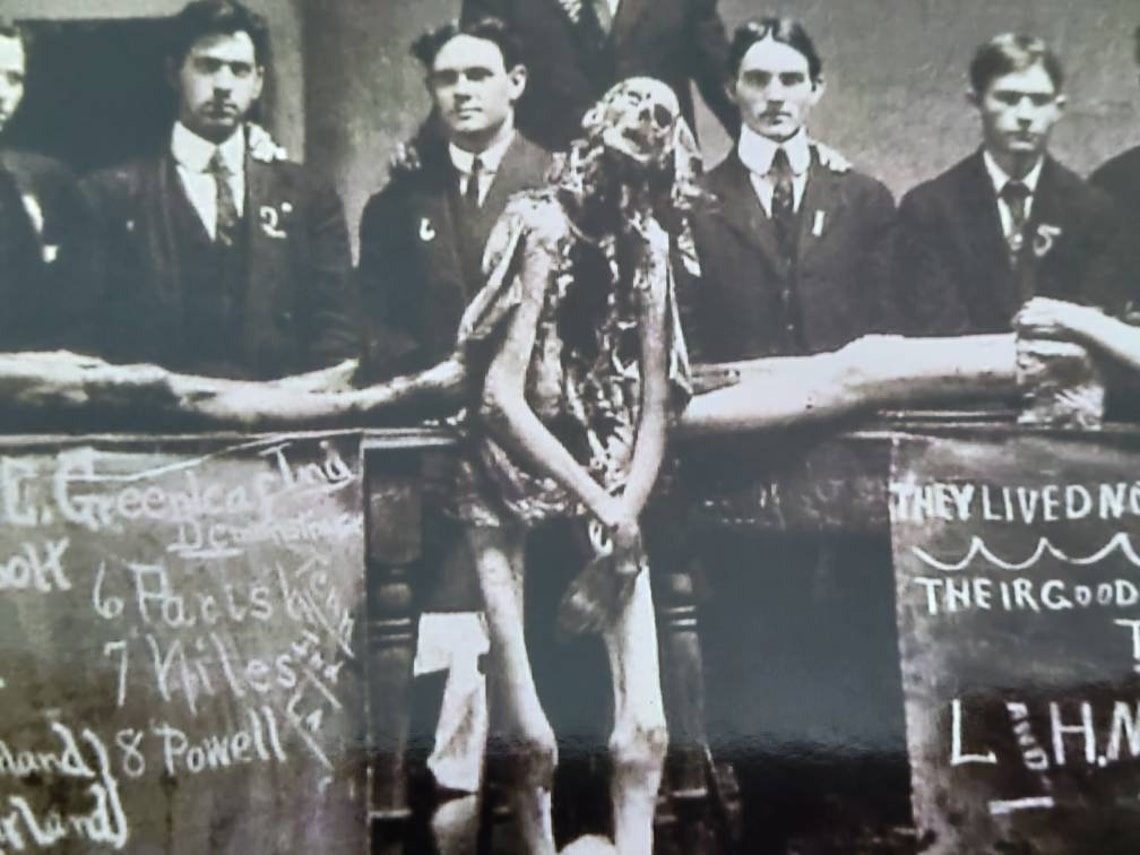 1900's Autopsy Medical Class Reprint Black and White | Etsy Österreich