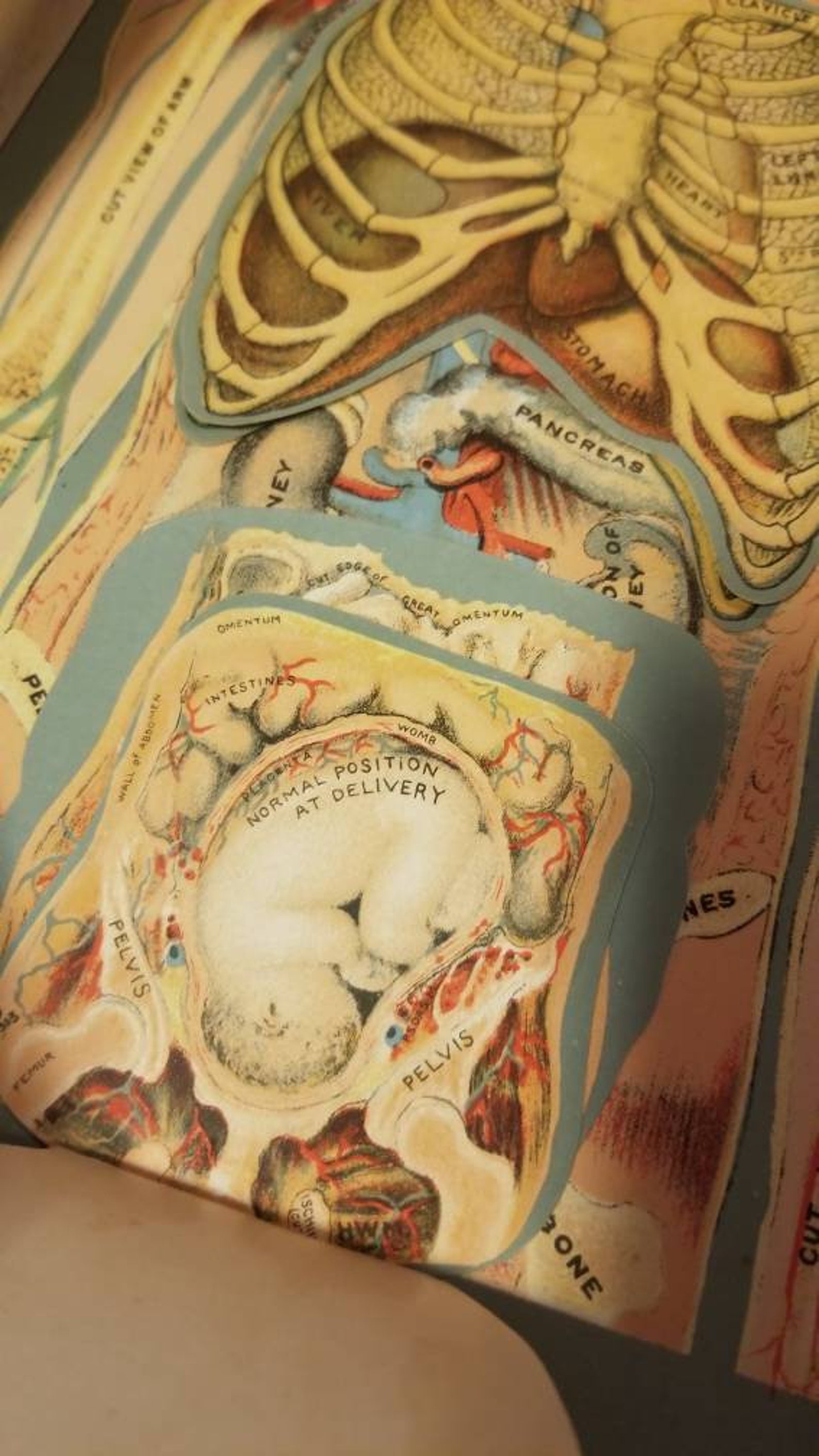 Antique Medical Overlays, Book Plate, Medical Lithographs, Anatomy ...